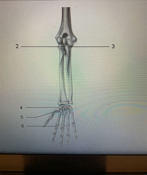 Solved Nts Com Identify Each Type Of Synovial Joint By Chegg Com