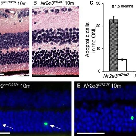 Histologic Analysis Shows Degeneration Of The Photoreceptors In Mutant