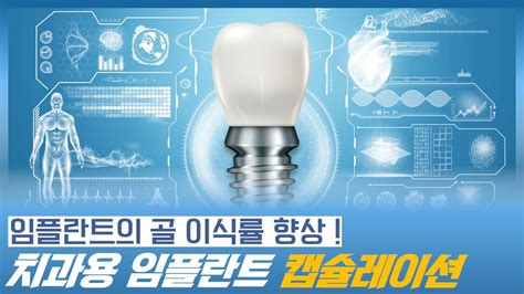임플란트의 골 이식률을 높이는 치과용 임플란트 캡슐레이션 개발 임플란트 임플란트 장비 Youtube