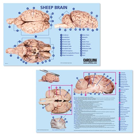 Carolina® Brain Dissection Mat Carolina Biological Supply