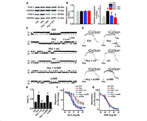 Inhibition Of COX 2 By Celecoxib Attenuates Hcy Induced Increase In