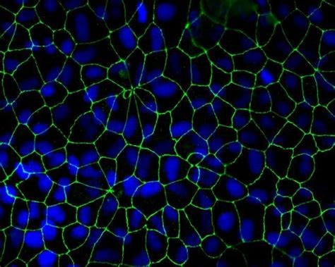 Zo 1 Monoclonal Antibody Zo1 1a12 Invitrogen 100 μg Unconjugated