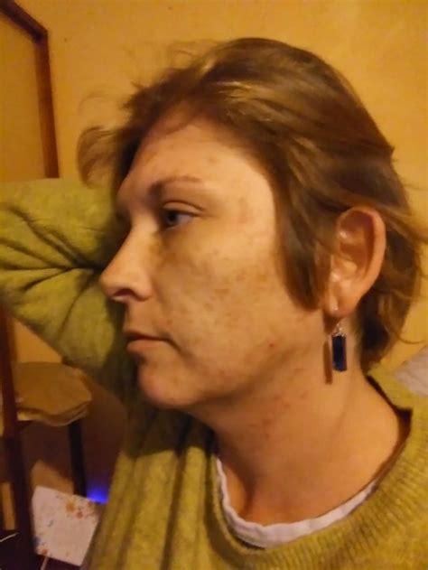 Does This Look Anything Like What Has Happened To Any Of You Seeing A