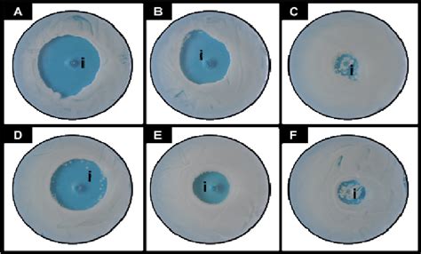 Bio Assays Of Cryptococcus Neoformans Var Neoformans Uofs Y 1378 A To Download Scientific