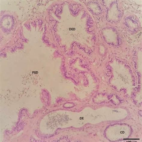 Survey Photomicrograph Of The Excurrent Duct Of Guinea Fowl Numida