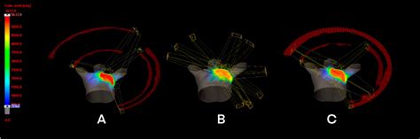 Table 1 From Evaluation Of Hybrid Vmat Advantages And Robustness Considering Setup Errors Using