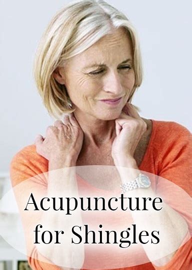 Can Acupuncture Help You With Shingles Acupuncture Continuing Education