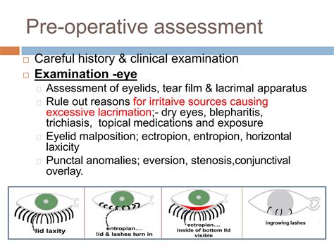 Endoscopic Dcr Ppt