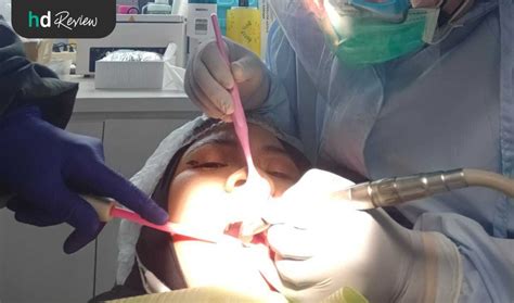 Review Pelepasan Behel Di Klinik Gigi Dewi Hdmall