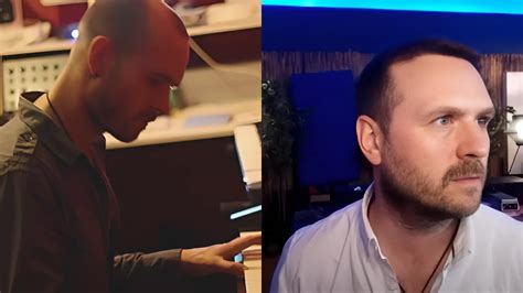 irish music icon damian brady spills on his hair transplant journey
