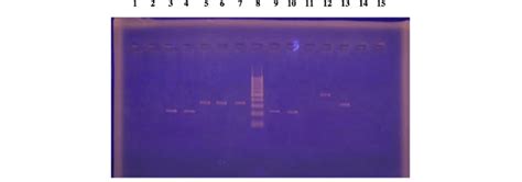 Agarose Gel Electrophoresis Of Pcr Of Gbs Virulence Genes Lane 8 Dna
