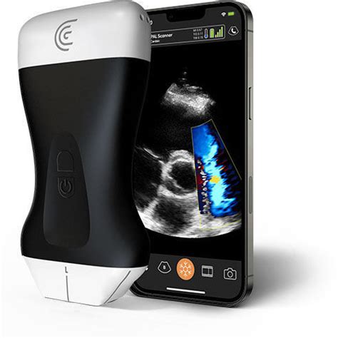 手持式B超机 PAL Clarius Mobile Health 用于多功能超声检查 腹腔和盆腔超声成像 用于心血管超声检查