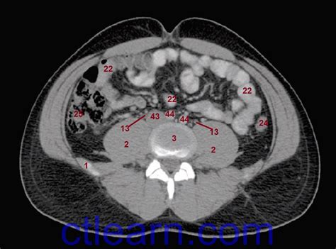 Ct Scan Abdomen Pelvis Anatomy