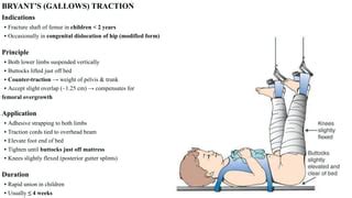 Comprehensive Guide To Traction And Splints In Orthopedic Care Pdf