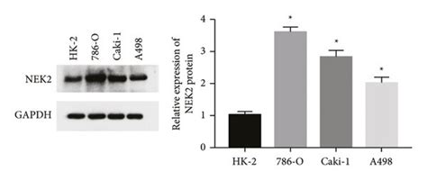 Elevated NEK2 Was Found In CcRCC Tissues And Cell Lines A NEK2