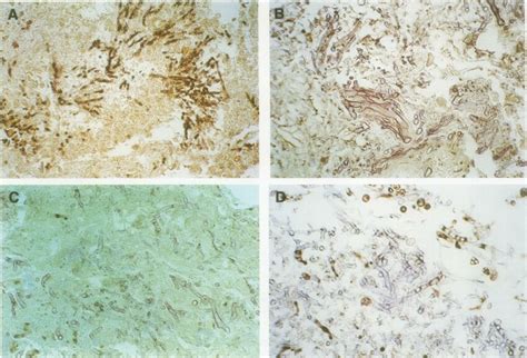Immunostaining Offormalin Fixed Paraffin Wax Embedded Tissue Sections