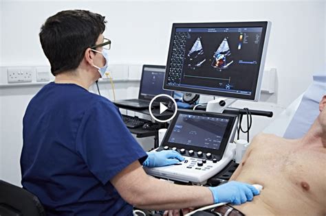 Echocardiogram 20 Faqs On Heart Health And Echo Test