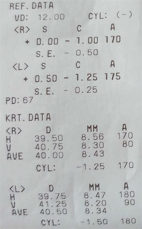 Диаметр и радиус кривизны контактной линзы - Вопрос офтальмологу - 03 ...