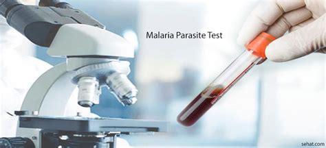 Malaria Parasite Test Procedure Principle Results Interpretation