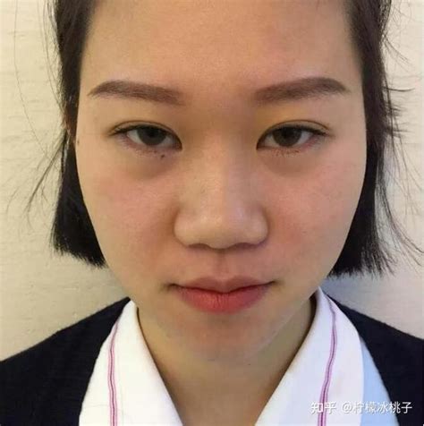 济南do鼻子两个月 内含干货 记得点赞收藏哦~ 知乎