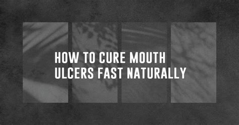 How To Cure Mouth Ulcers Fast Naturally