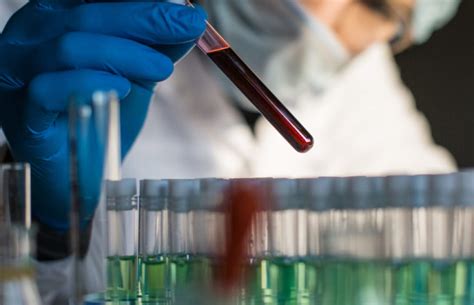 Blood Test Can Detect 50 Different Types Of Cancer News Coil Fitness