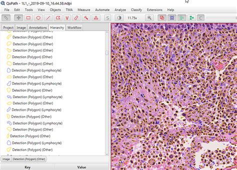 Qupath Python Import Export Instance Segmentation Masks For Binary