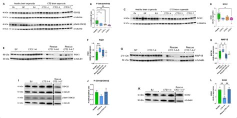 Relationship Between Gsk3β And Neurogenesis Deficit A B