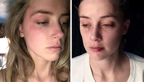 Amber Heards Pr Team Gets Emails Leaked ‘phots Of Bruises Are Fake