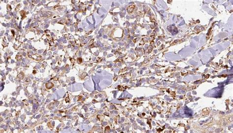 Anti Osteonectin Sparc Antibody Rabbit Anti Human Polyclonal Lsbio