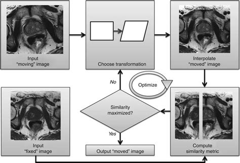 Mri Ultrasound Fusion Imaging Radiology Key