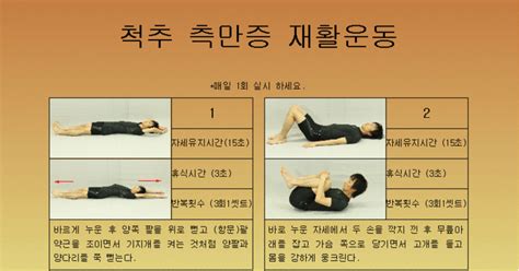 척추측만증의 원인과 재활운동 네이버 블로그