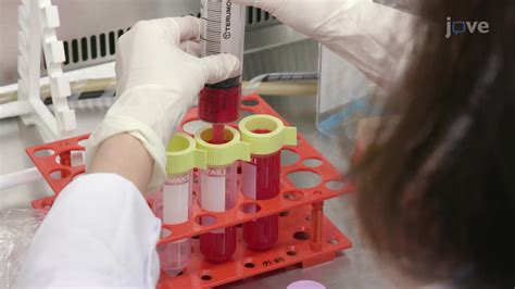Peritoneal Low Density Neutrophil Isolation A Technique To Obtain Low