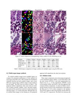 Sian Style Guided Instance Adaptive Normalization For Multi Organ