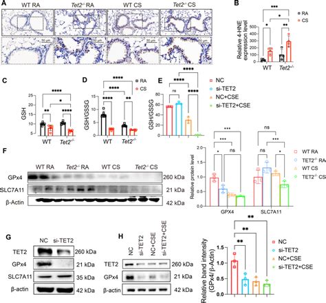 Dna Dioxygenases Tet2 Deficiency Promotes Cigarette Smoke Induced