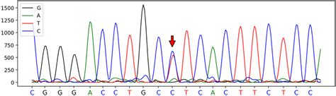 Genetic Study Findings The Genetic Sequencing Result Indicates An Exon Download Scientific