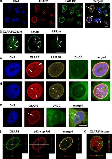 Intra Nuclear Localization Of Xlap2 As Correlated To Nuclear Antigens