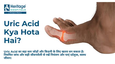 Uric Acid Kya Hota Hai Uric Acid Ke Lakshan In Hindi