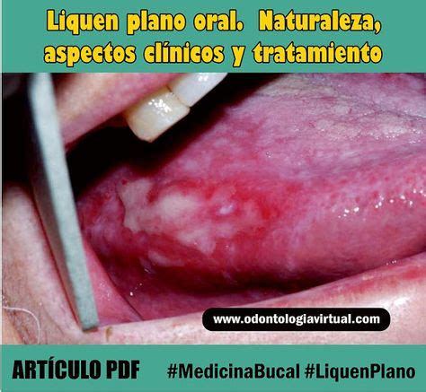 20 ideas de Patología patologia odontología dental