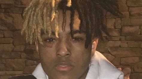 Xxxtentacion Dead Best Audio Qualityog Youtube
