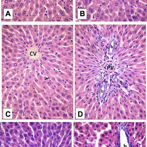 Photomicrographs Of Rats Liver Showing Anastomosing Plates Of Download Scientific Diagram