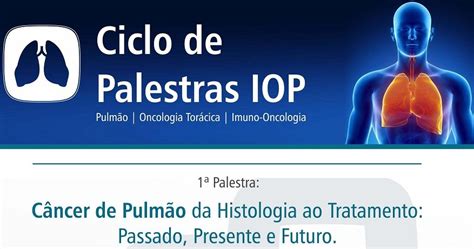 Fato Agenda Iop Traz Oncologista Do Instituto Nacional De CÂncer Para