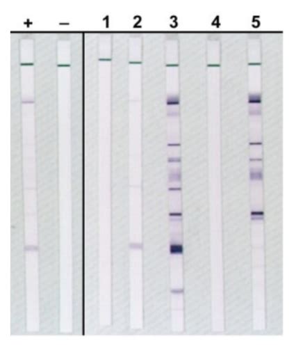 Serological Techniques MCQs Flashcards Quizlet