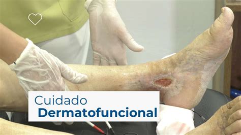 Beneficios de la Fisioterapia Dermatofuncional y Estética