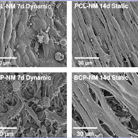 Scanning Electron Micrographs Showing The Morphology Of Mg63 Cells