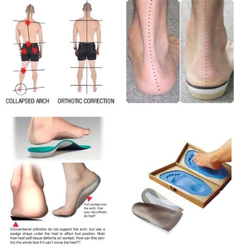 Custom Orthotics Specialists In Nyc Manhattan Foot Specialists