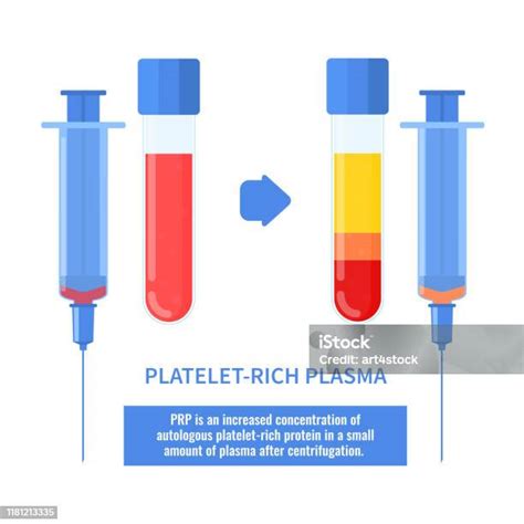 Platelet Rich Plasma Therapy Procedure Infographics Poster Stock