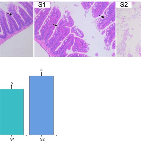 Intestine Morphology Of Zebrafish Fed With And Without Supplementation