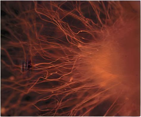 Mrna Therapys Promise For Chronic And Acute Liver Disease