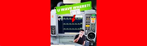 The Elusive U Wave Ems Cardiology Lights Sirens Action Ems